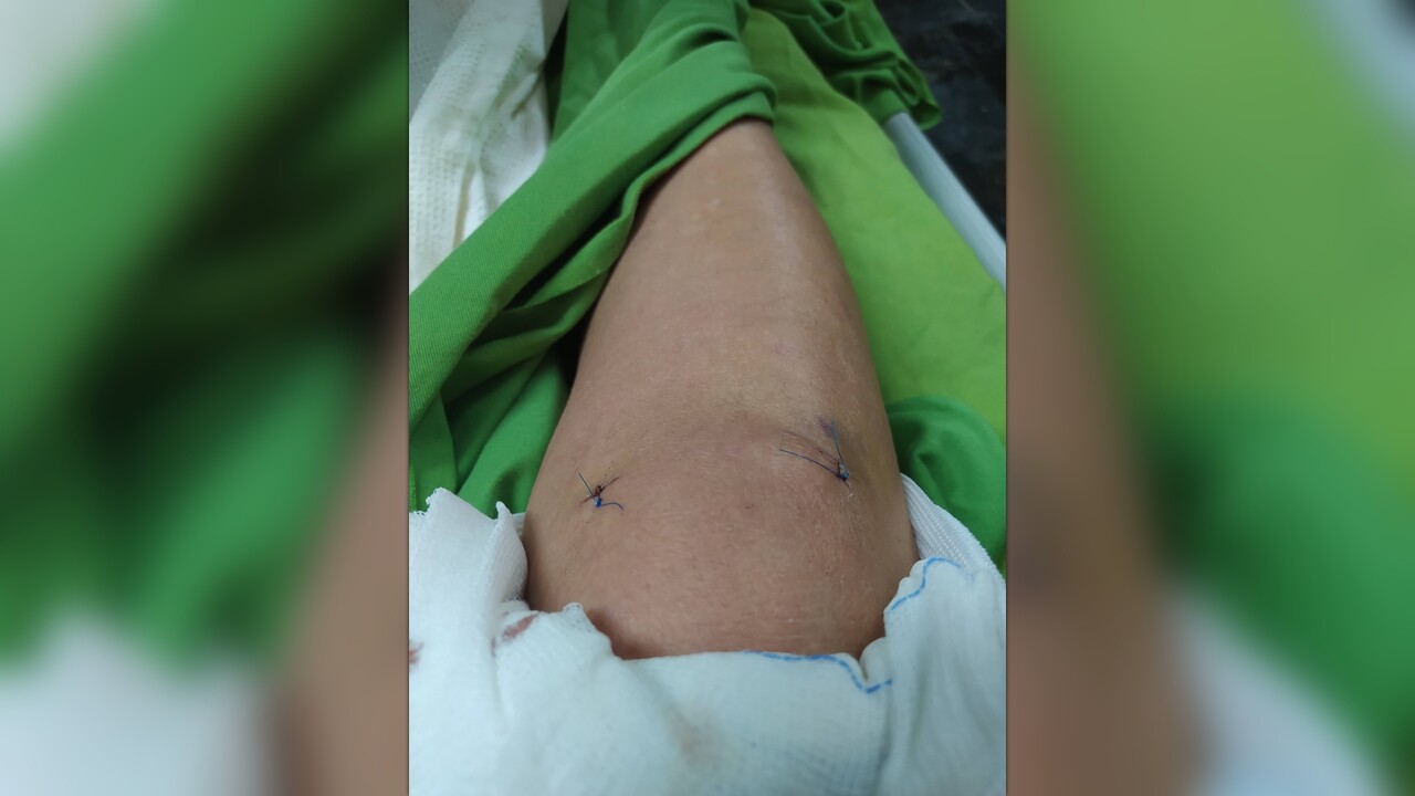 AYUDAME CON LA RECUPERACIÓN y REHABILITACIÓN DE LA MOVILIDAD DE MI ...