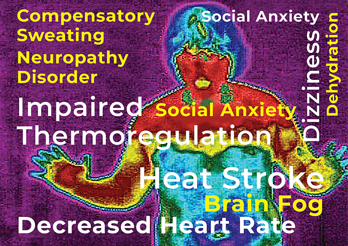 Please Help James recover from his Compensatory Sweating. by James Tsai